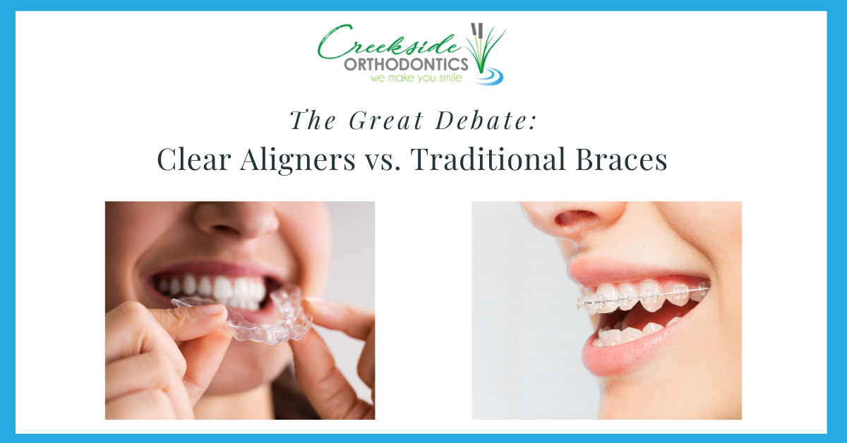 Aligners vs. Braces in Vacaville, CA | Creekside Orthodontics